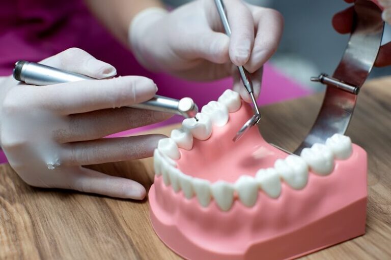 How Dental Sealants Heal and Restore Your Molar Teeth? - D. Dental